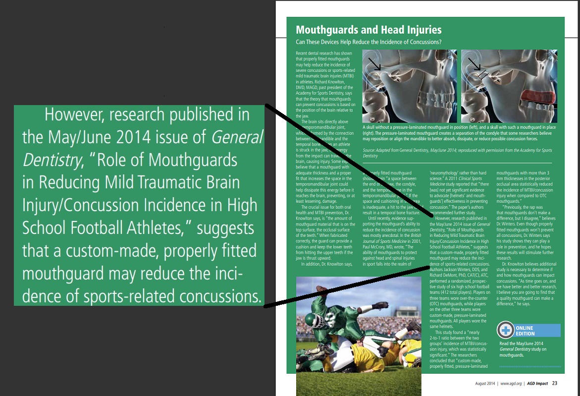Concussion – EDGE Sports Guard